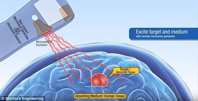 A Star Trek-like device to detect cancer tumors - ProtoThema English