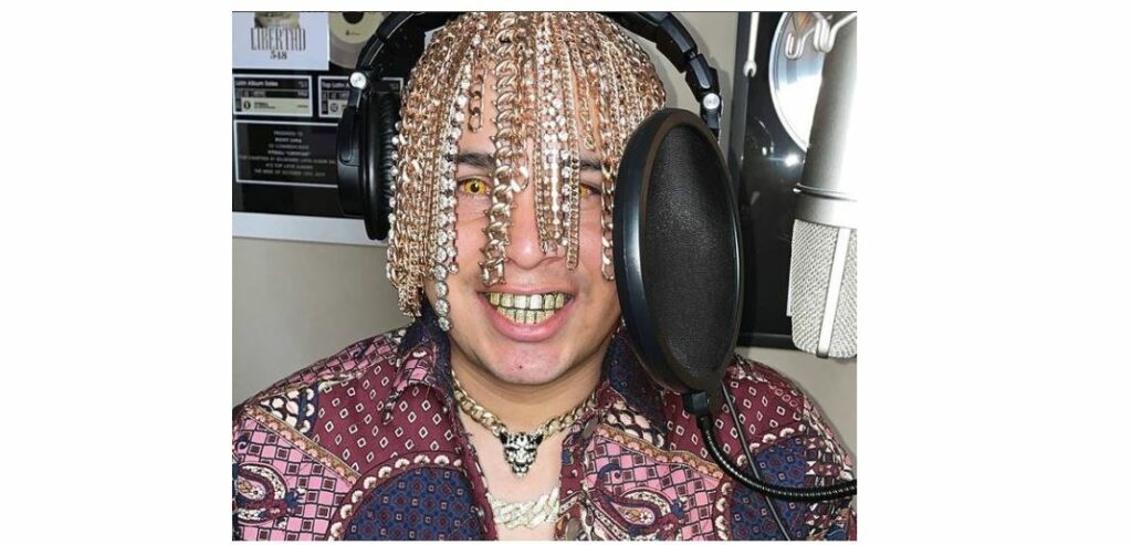 Rapper gets gold chains as hair implanted! - ProtoThema English