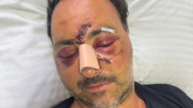 Crete: Two men surrender for the brutal beating of a Greek-Canadian in ...